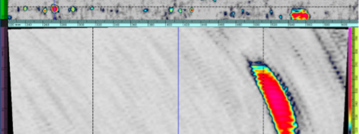 5 Main Advantages of Phase Coherence Imaging (PCI) | Blog Post ...